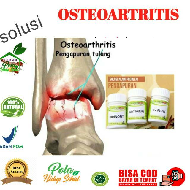 Jual OBAT RADANG SENDI HERBAL SOLUSI PENGAPURAN TULANG & SENDI ...