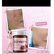 Jual KEMASAN BARU GLUTA INFINITY BERRY WHITENING CAPSULE GLUTA FROZEN ...