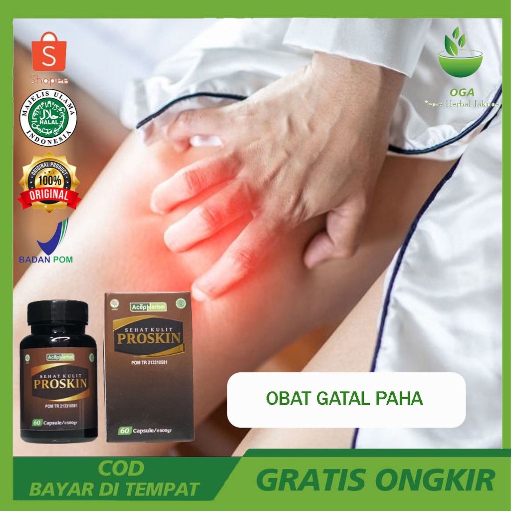 Jual Obat Gatal - Gatal di Bagian Paha Gatal Selangkangan Jamur ...