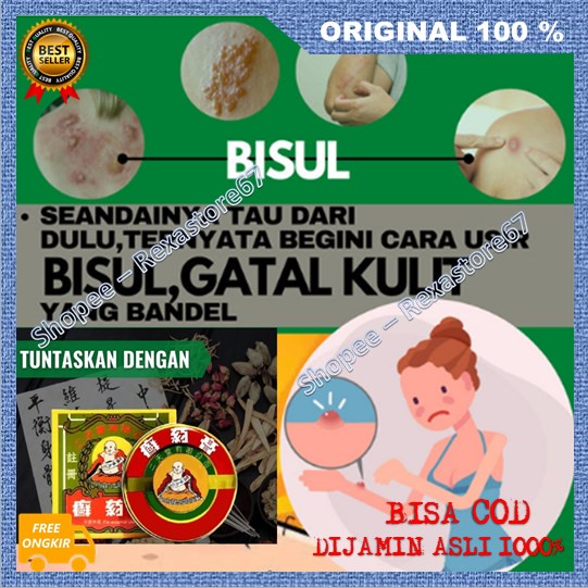 Jual BELI 1 GRATIS 1 Zhu Ruangao Salep Bisul Gatal Selakangan Panu ...
