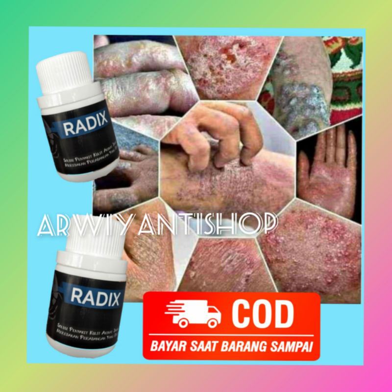 Jual (COD) RADIX OBAT KULIT EXIM 3x DI OLES 7 HARI HILANG PERMANEN ...