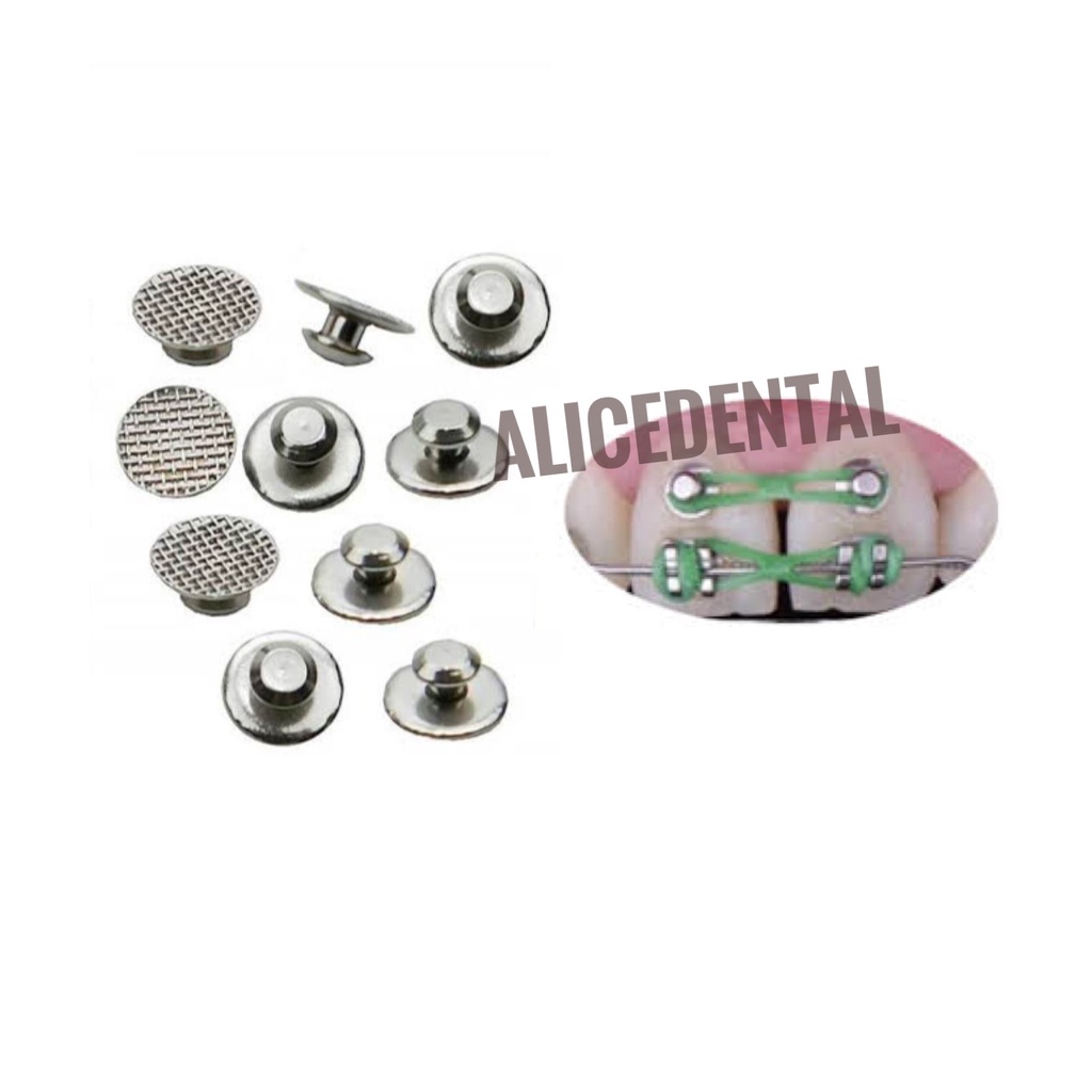 Jual Dental Lingual button round lingual button bulat isi 10 braces ...