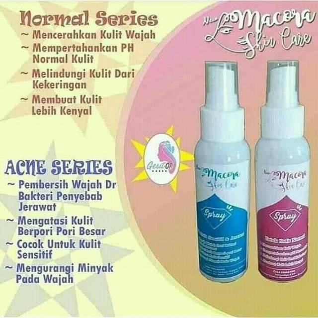 Jual Spray macora normal& acne /macora/spray macora | Shopee Indonesia