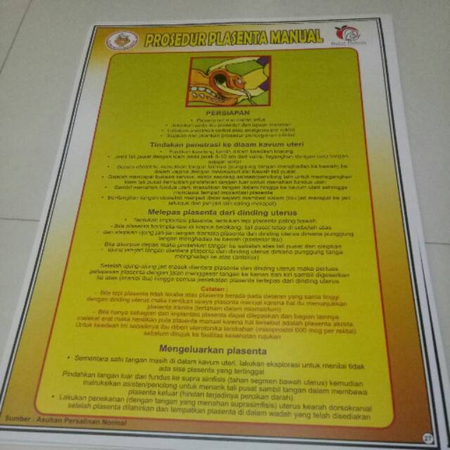 Jual Poster Prosedur Plasenta Manual | Shopee Indonesia