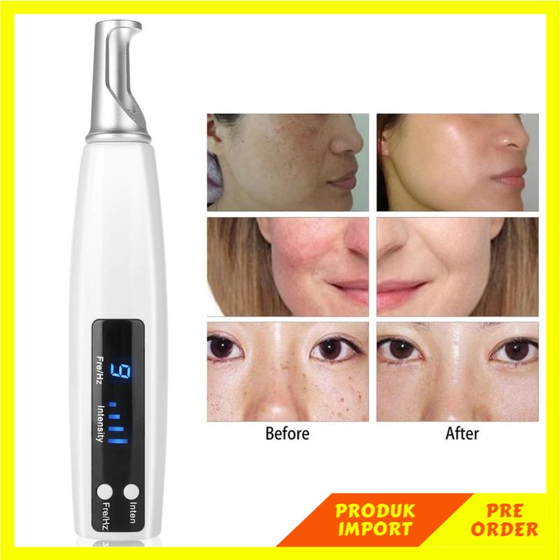 Jual PRODUK IMPORT Upgraded Picosecond Laser Pen Pulse Light Tattoo ...