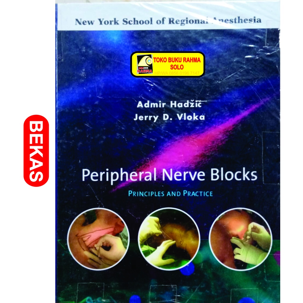 Jual Peripheral Nerve Blocks Principles And Practive Admir Hadzic Jerry ...