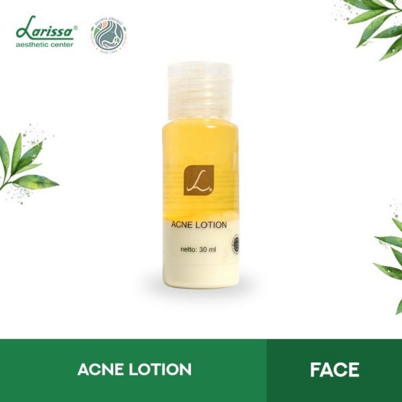 Jual ACNE LOTION LARISSA (OBAT JERAWAT) | Shopee Indonesia
