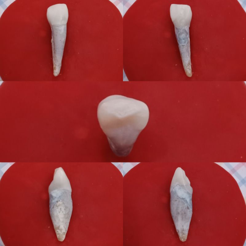 Jual Gigi 42 Gigi Asli Praktikum Gigi Insisif Lateral Kanan Rahang ...