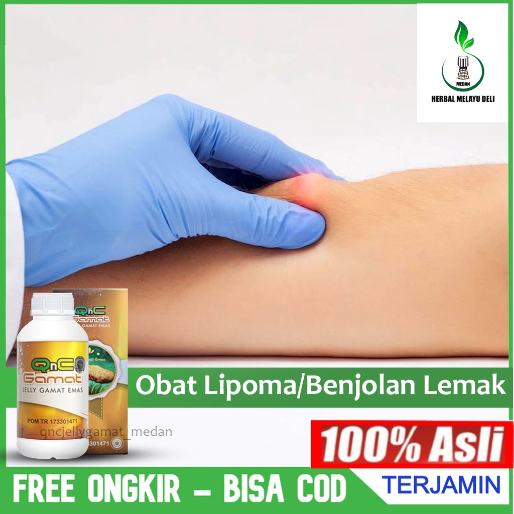 Jual Obat Lipoma Benjolan Lemak di Punggung Leher Lengan Bahu Paha dan ...