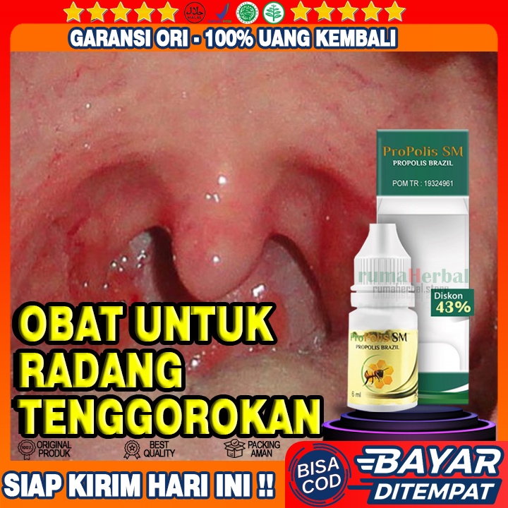 Jual Obat Tenggorokan Bengkak, Tenggorokan Luka, Tenggorokan Sakit, Tenggorokan Gatal ...