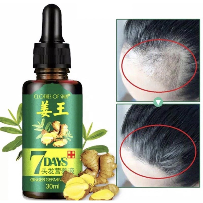 Jual 7 Days Clothes Of Skin Ginger Germinal Oil Minyak Penumbuh Rambut ...