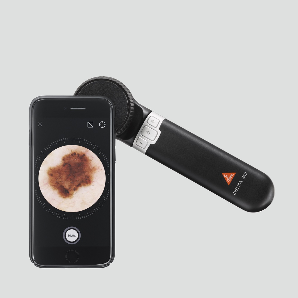 Jual Heine Delta 30 Dermoskopi Dermatoscope Dermatoscopy Alat diagnosa ...