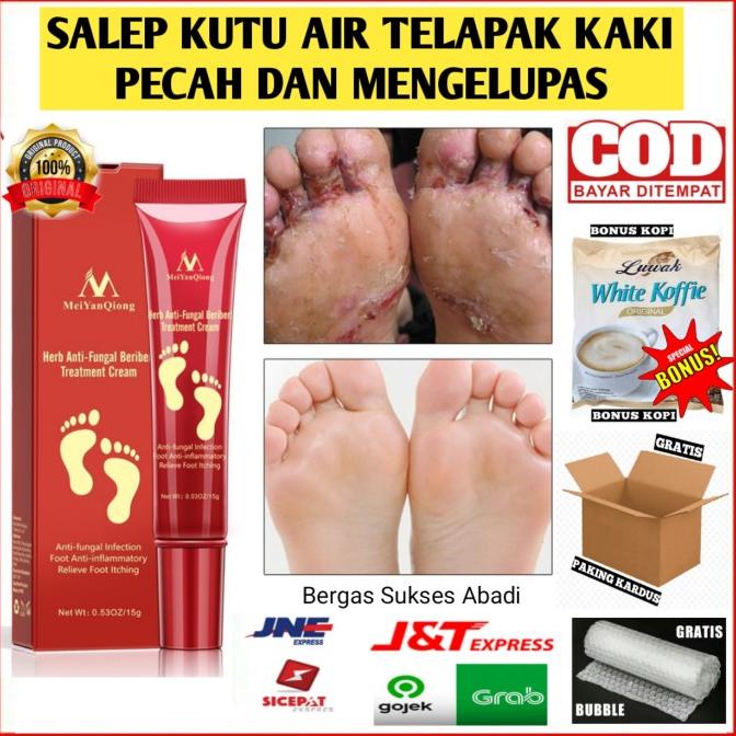 Jual SALEP KUTU AIR TELAPAK KAKI PECAH DAN MENGELUPAS KAPALAN | Shopee ...