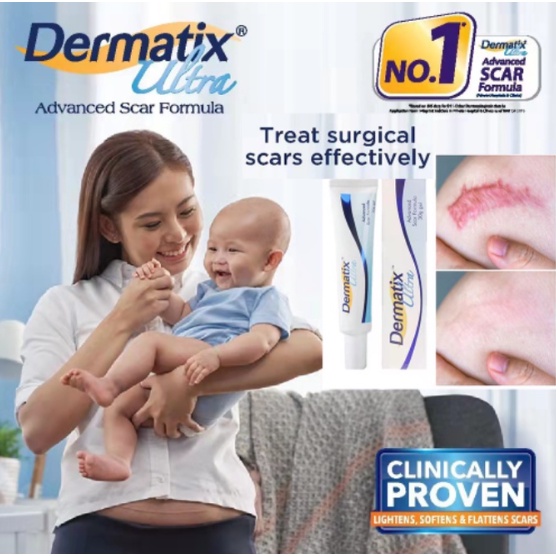 Jual Dermatix Ultra Gel 15gr Dermatic Cream Penghilang Bekas Luka Bakar ...