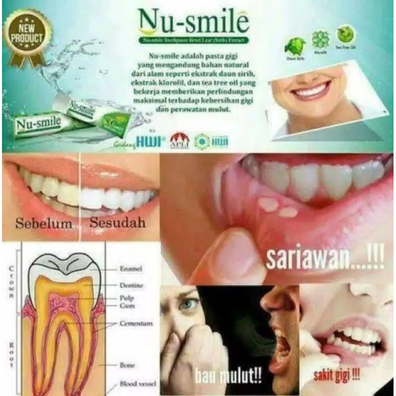 Jual Nu Smile Odol Herbal Ampuh Sembuhkan Sakit Gigi Sariawan Bau Mulut ...