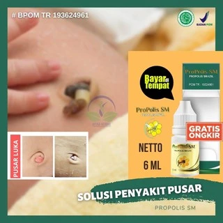 Produk Hisna Herbal | Shopee Indonesia