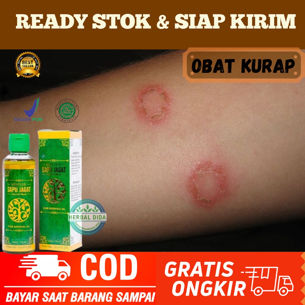 Jual Obat Oles Anti Kurap, Obat Jamur Kulit Gatal Gatal Kurap, Obat ...