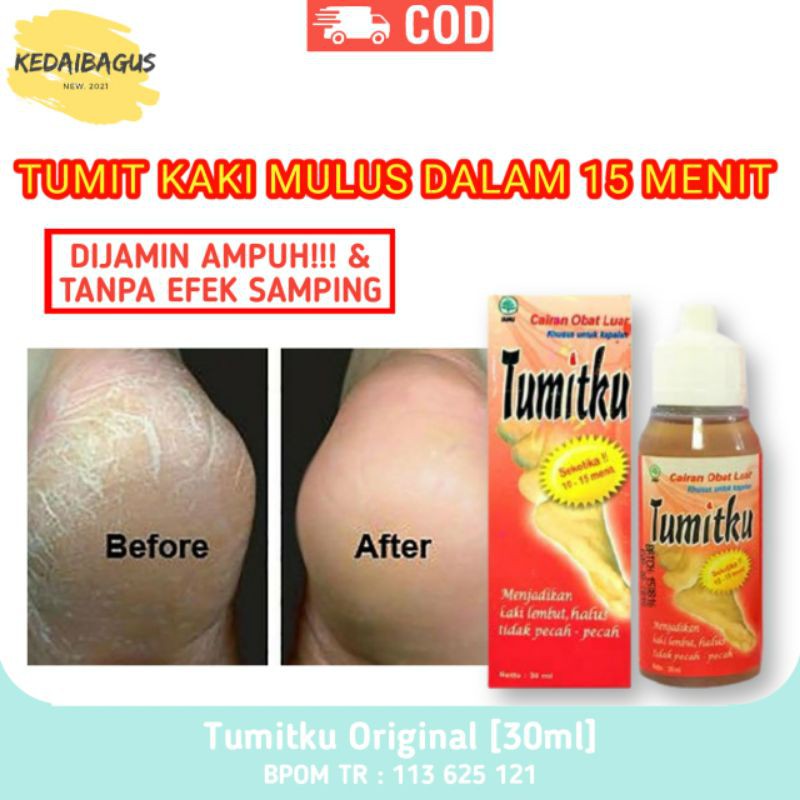Jual TUMITKU - Obat Tumit Kaki Pecah-pecah - Obat Tumit Pecah - Obat ...