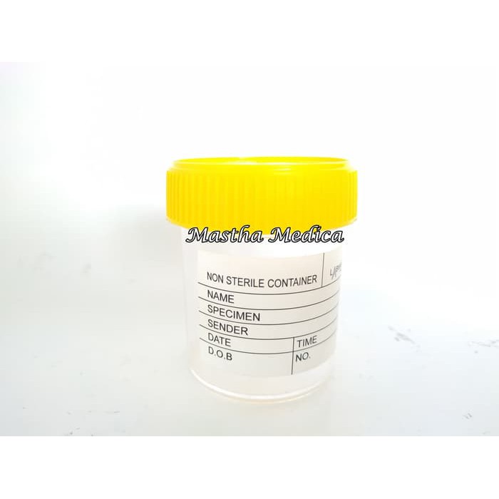 Jual Urine Container 60 ml / Tempat Sampel Urine Non Sterile | Shopee ...