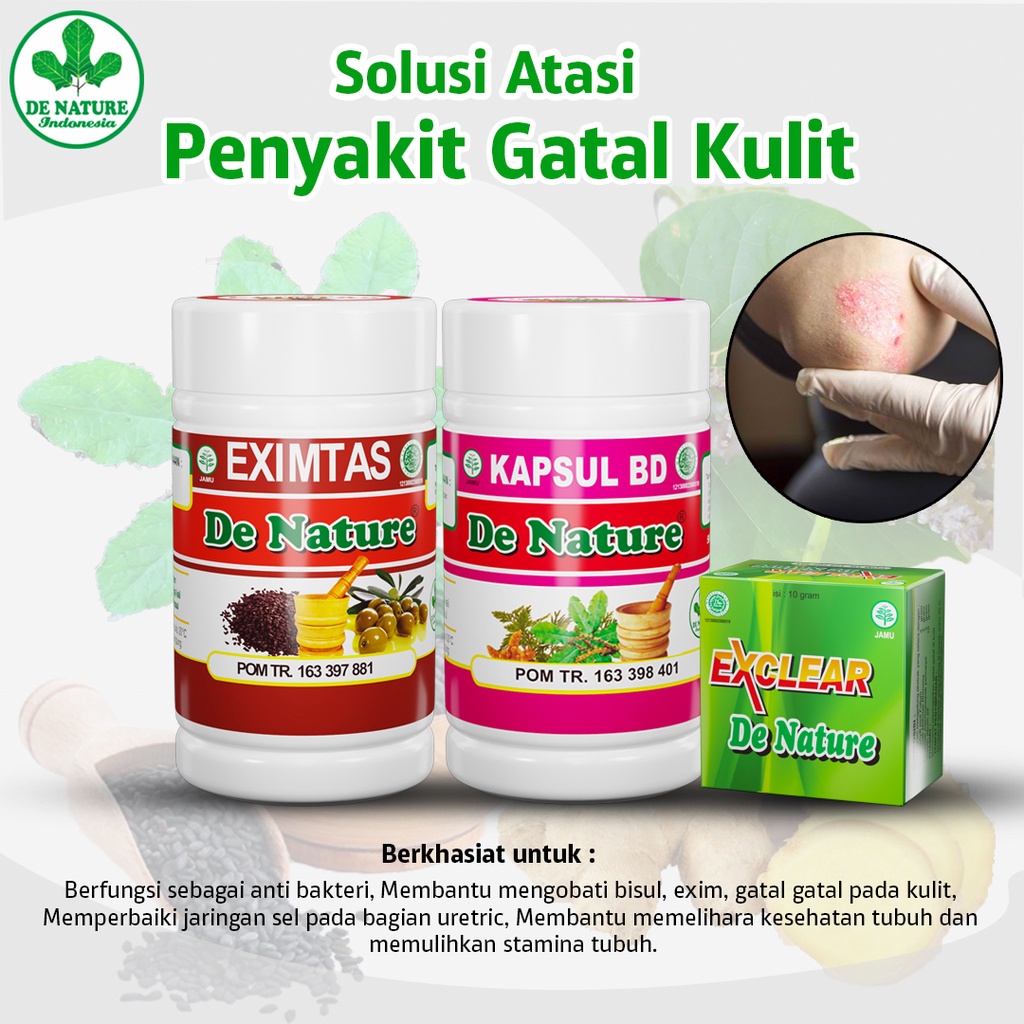 Jual Obat Gatal eksim Exim, Jamur di Selangkangan, Psoriasis Gatal ...
