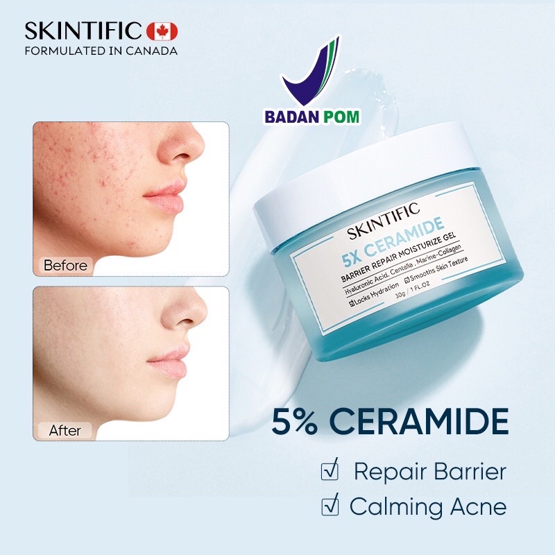 Jual SKINTIFIC 5X Ceramide Barrier Repair Moisture Gel Moisturizer 30g ...