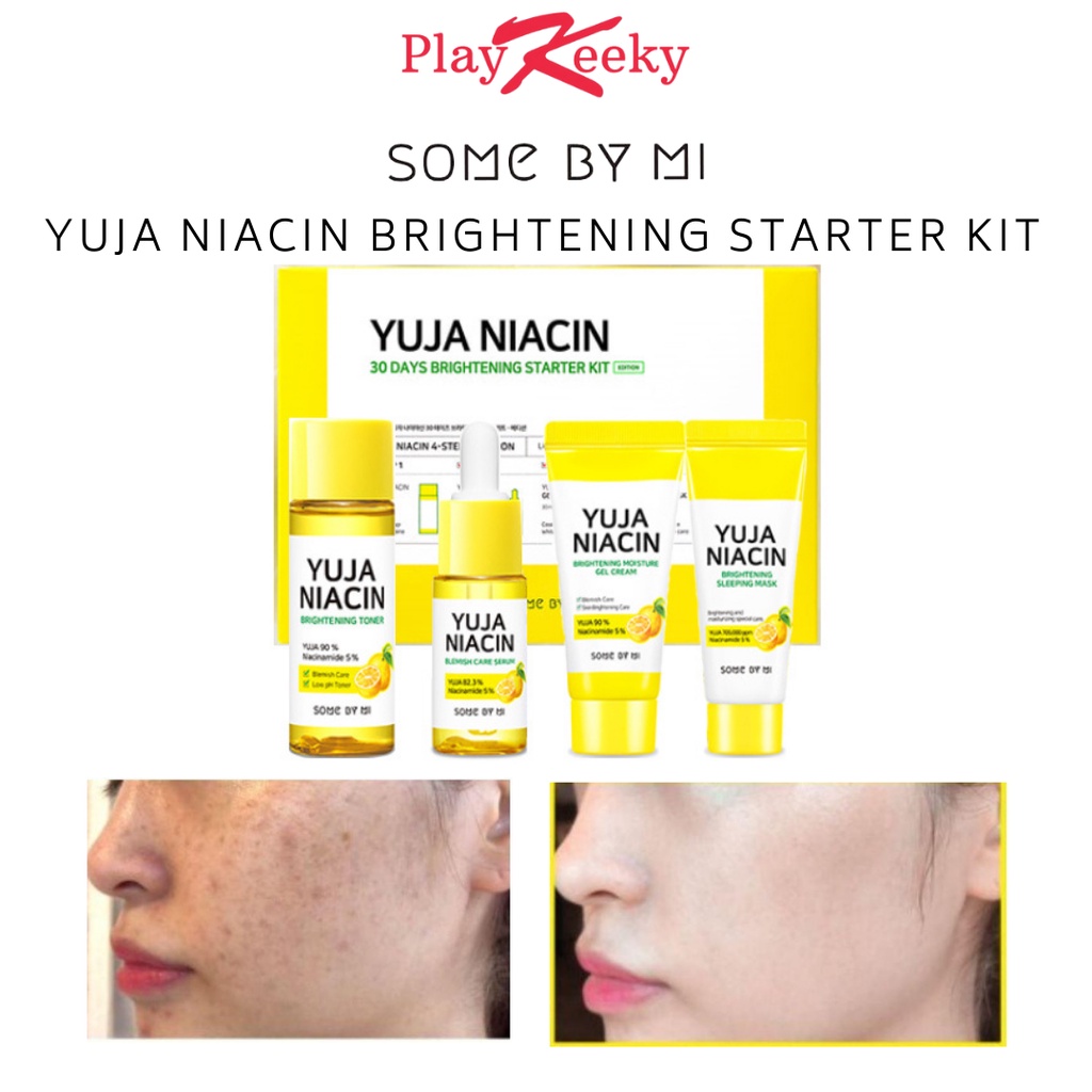 Jual Some By Mi Yuja Niacin 30 Days Brightening Starter Kit Edition 4 ...