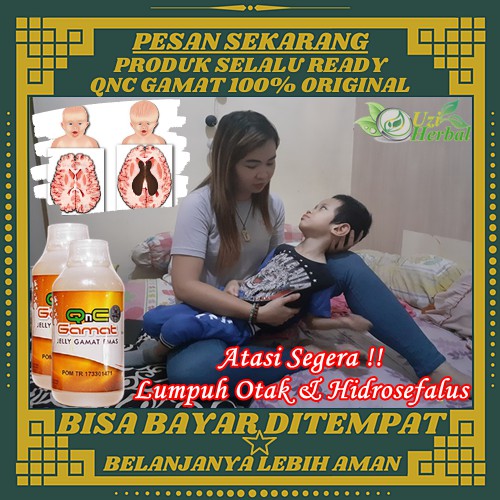 Jual QnC Jelly Gamat Obat Lumpuh Otak, Hidrosefalus, Penumpukan Cairan ...