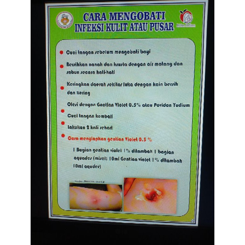 Jual POSTER CARA MENGOBATI INFEKSI KULIT ATAU PUSAR (NO 38) | Shopee ...