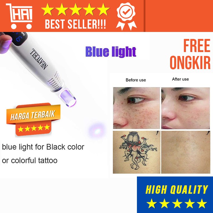 Jual LASER PENGHILANG TATTO DARK SPOT TAHI LALAT TUBUH PENGHAPUS TATO ...