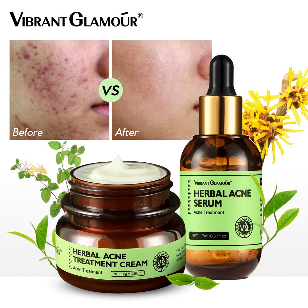 Jual VIRBANT GLAMOUR ACNE GLOW Acne Treatment Cream/Serum Herbal Obat ...