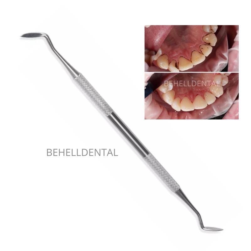 Jual ALAT KIKIR PENGHILANG PLAK KARANG TARTAR GIGI SONDE PIPIH 2 SISI ...