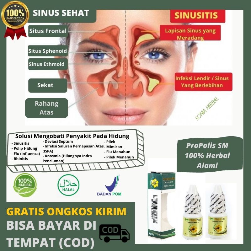 Jual Obat Tetes Sinusitis 100% Herbal, Obat Hidung Sinusitis, Obat ...
