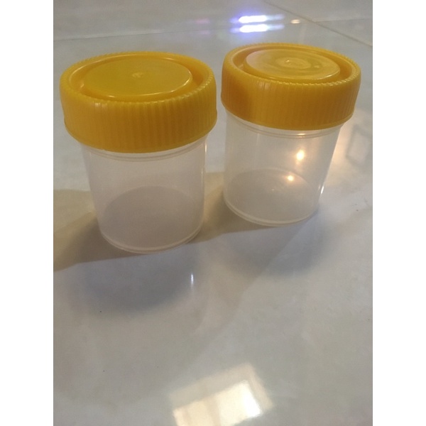 Jual Urine Container Non Steril 60ml Pot Urin Wadah Sampel Urine ...
