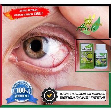 Jual Obat Alami Mata Kering dan Pandangan Kabur Ekstrak Daun Kelor ...