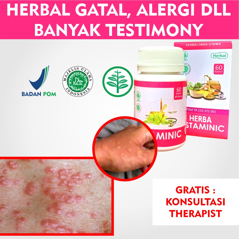 Jual Obat Salep Gatal, Alergi, Eksim Ampuh - Kapsul isi 60 (Nusantara ...
