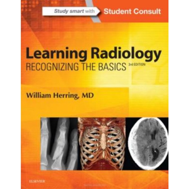 Jual Learning Radiology: Recognizing the Basics ukuran B5 | Shopee Indonesia