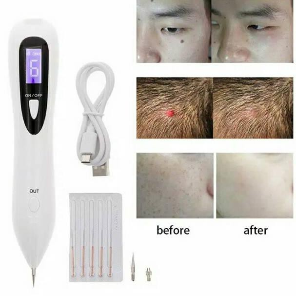Jual laser penghilang flek tai lalat tatto bopeng kutil tato flek mole ...