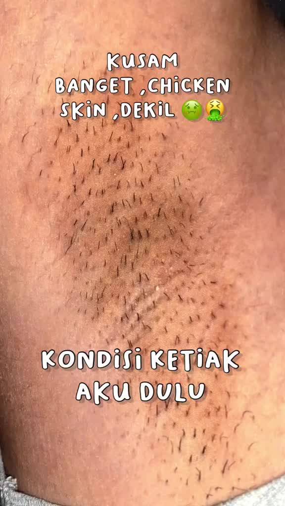 Jual Brighty Glowing Underarm X Underarm Scrub (Limited Package ...