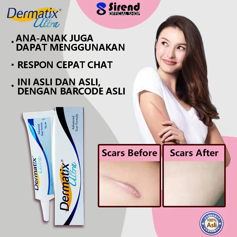 Jual Dermatix Ultra Gel 15g dermatix penghilang bekas luka penghilang bekas luka dermatix ultra ...