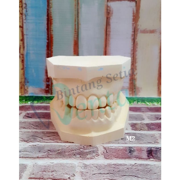 Jual MODEL GIGI GIP KUNING M2 // M3 (GIPS TIPE III) | Shopee Indonesia