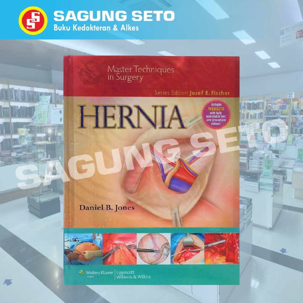 Jual MASTER TECHNIQUES IN SURGERY HERNIA-JONES / BEDAH | Shopee Indonesia