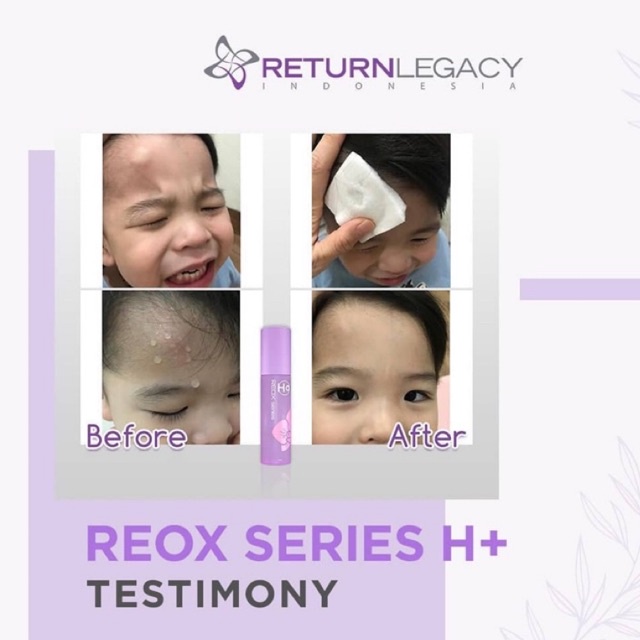 Jual PROMO 12.12 Return Legacy REOX Series H+ (Spray Anti Oksidan ...