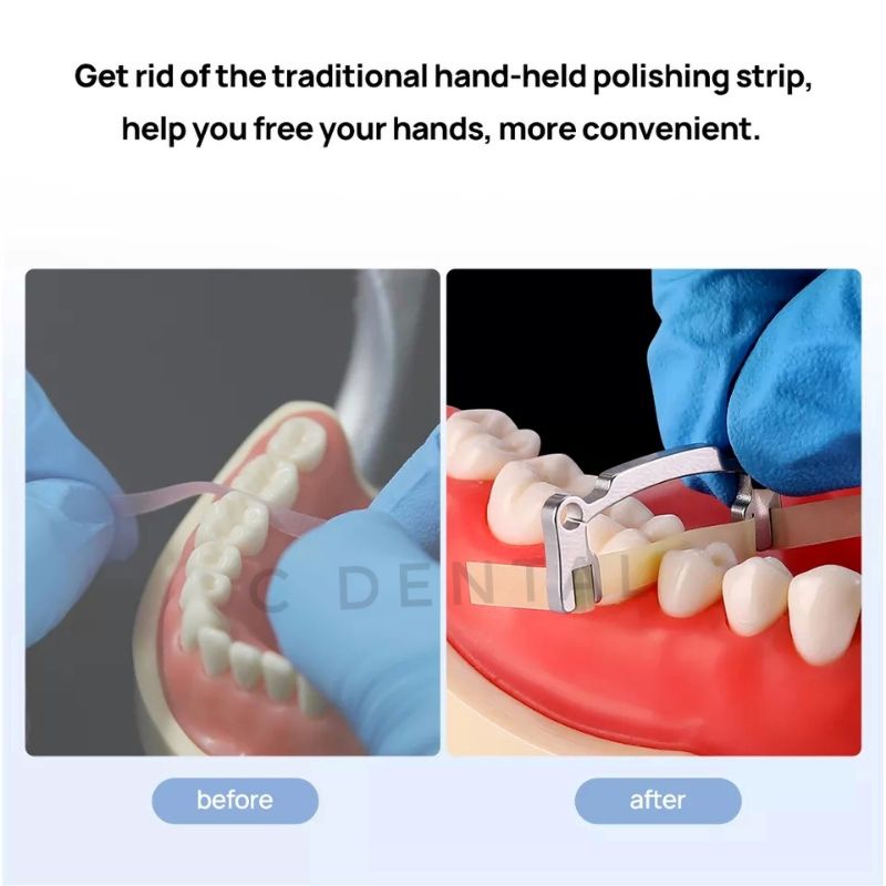 Jual Dental Holder Clip Strip Polishing Komposit/Ortho Slicing/Benang ...