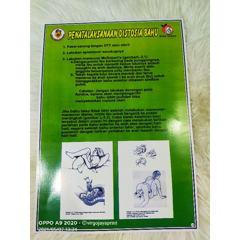 Jual (13) Poster penatalaksana distosia bahu | Shopee Indonesia