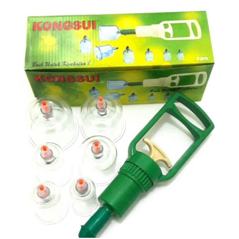 Jual Alat bekam / kop angin isi 6pc kongsui kecil | Shopee Indonesia
