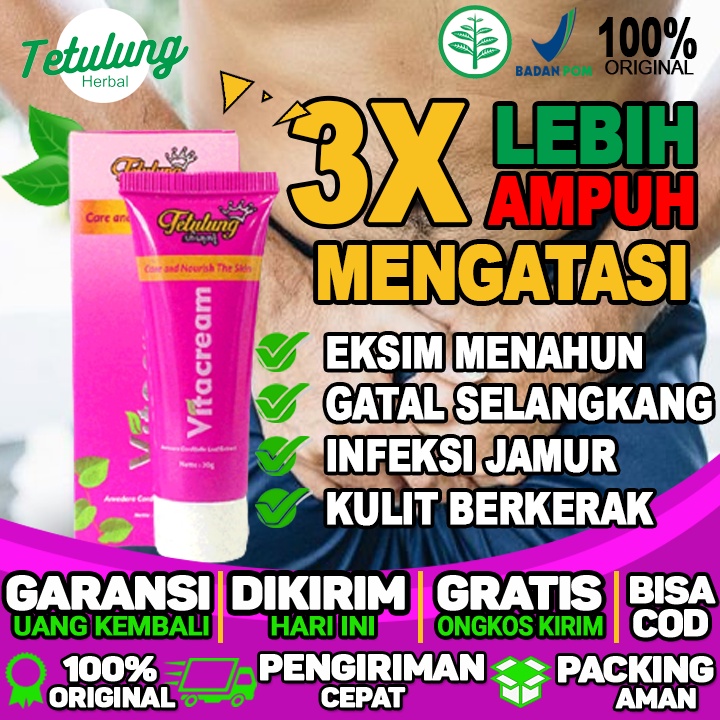 Jual Obat Eksim Kering Dan Basah Gatal Selangkangan Skabies Dermatitis ...