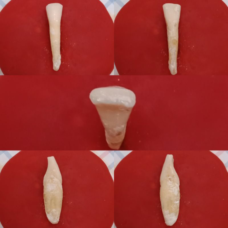 Jual Gigi 42 Gigi Asli Praktikum Gigi Insisif Lateral Kanan Rahang ...