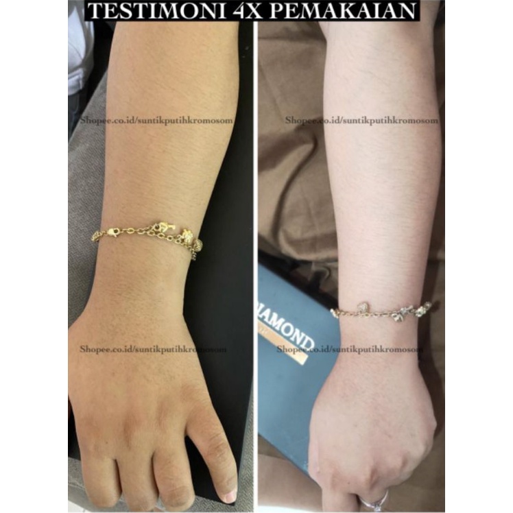 Jual Chromosome Diamond / suntik putih / suntikputih / whitening ...