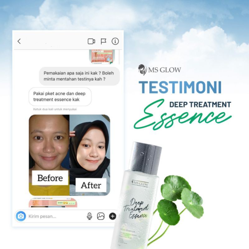 Jual Deep treatment essence | Shopee Indonesia
