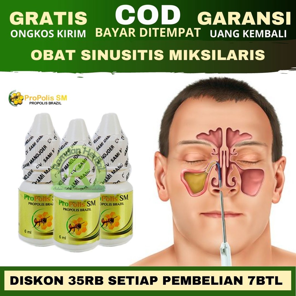 Jual Obat Sinusitis Maksilaris Hidung Berlendir Kental Sinus Penciuman ...